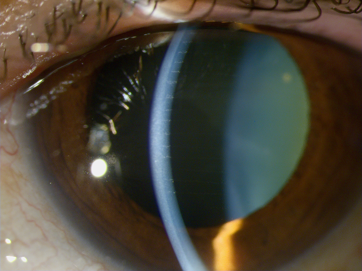 Imaging Module IM910